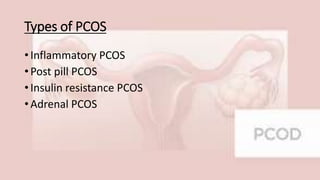 Polycystic ovarian Disease Causes & Prevention | PPTX