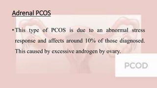 polycystic Ovarian Disease causes & Prevention | PPTX