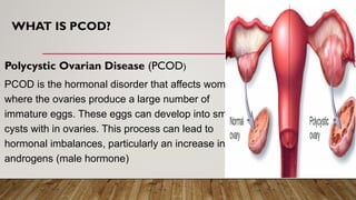 PCOD,PCOD problem,PCOD Treatment, PCOD symptoms | PPTX