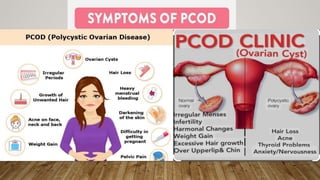 PCOD,PCOD problem,PCOD Treatment, PCOD symptoms | PPTX