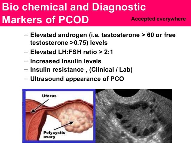 Polycystic Ovarian Disease & Hyperandrogenism Evidence Based Updat…