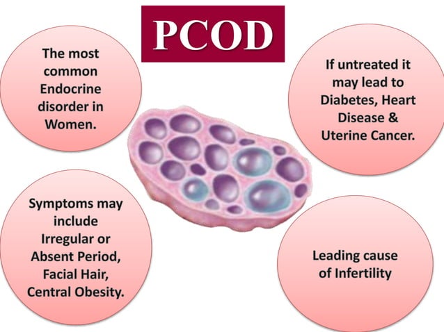 Life Style Modifications IN PCOD Dr. DEEPIKA KOHLI / Dr. SHARDA JAIN ...