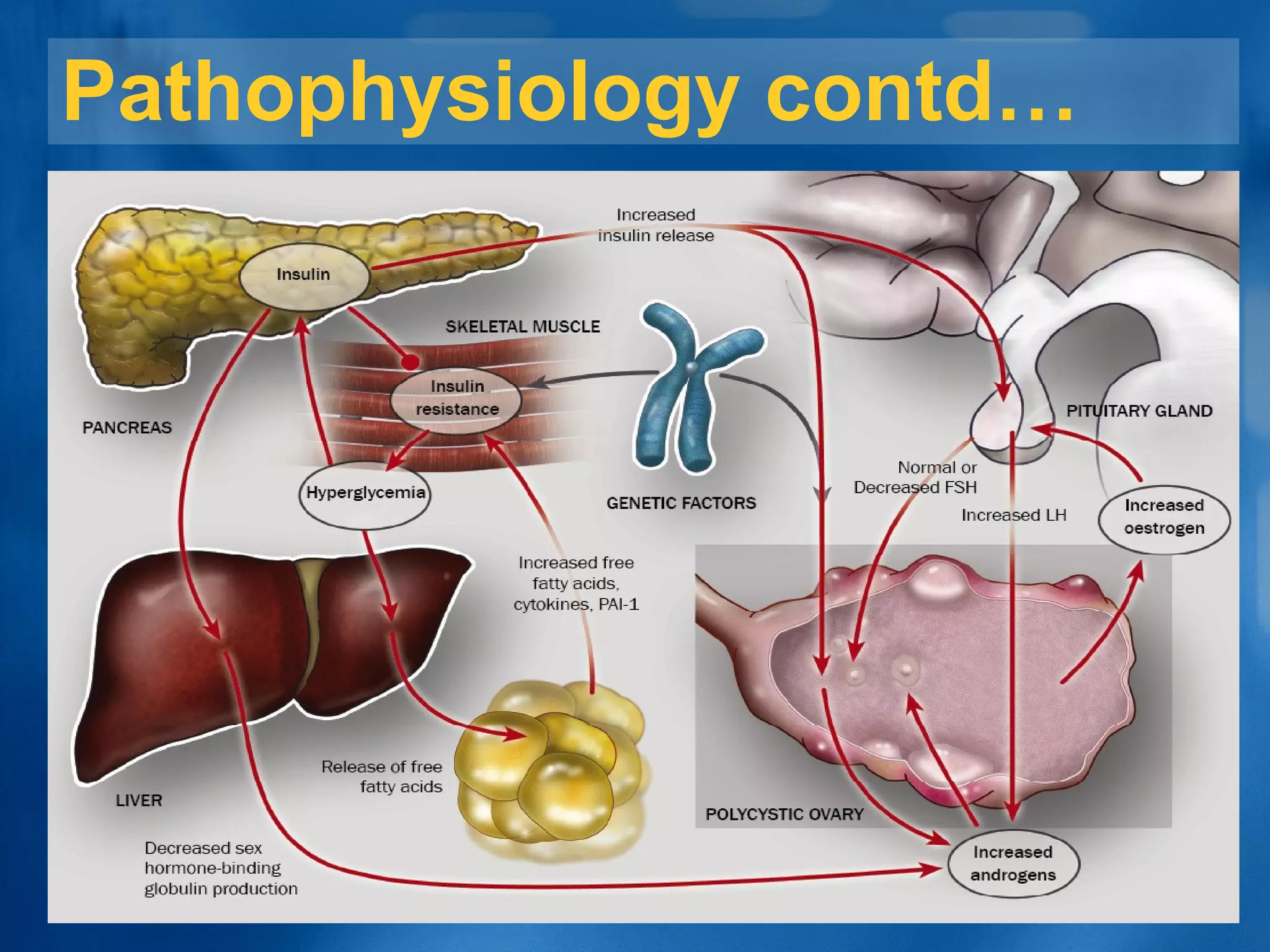 PCOD (Polycystic Ovarian Disease) | PPT