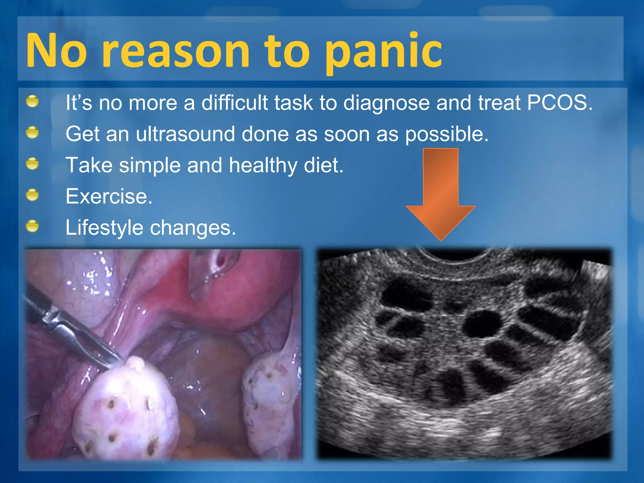 PCOD (Polycystic Ovarian Disease) | PPT