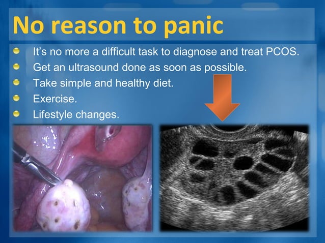 PCOD (Polycystic Ovarian Disease) | PPT | Infertility | Reproductive Health