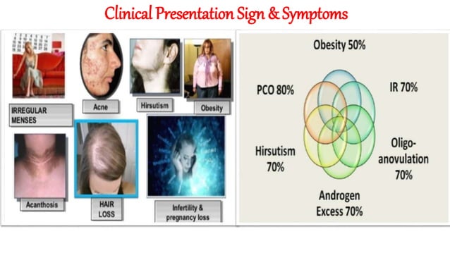 Pcod presentation | PPT | Free Download