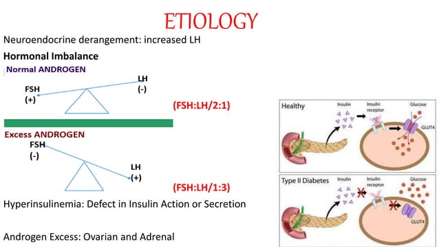 Pcod presentation | PPT