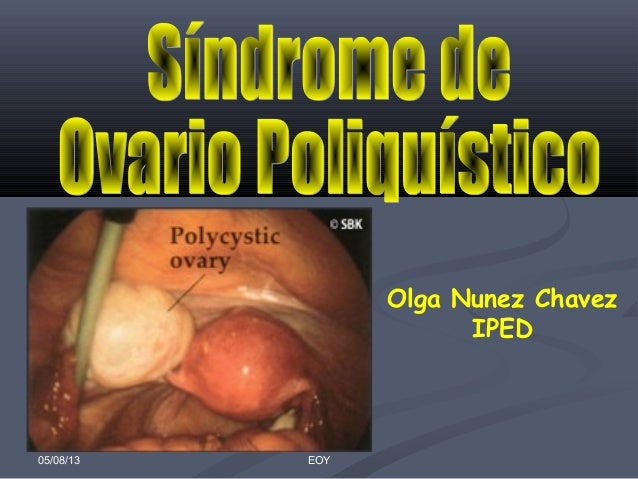 OVARIO POLIQUISTICO