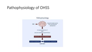 Polycystic ovarian disease revision notes (PCOD) | PDF