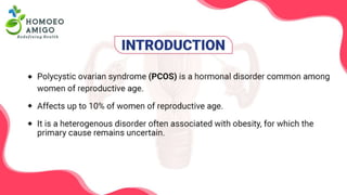 Pcos and Homoeo Amigo | PPT