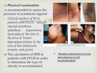 PCOS.pdf | Hormonal Disorders | Endocrine and Metabolic Diseases