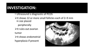 PCOS.pptx