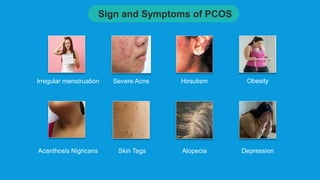 Pcospcos pcos pcos pcos pcos pcos pcos.pptx