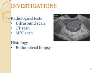 PCOS polycystic ovarian syndrome presentayiom | PDF