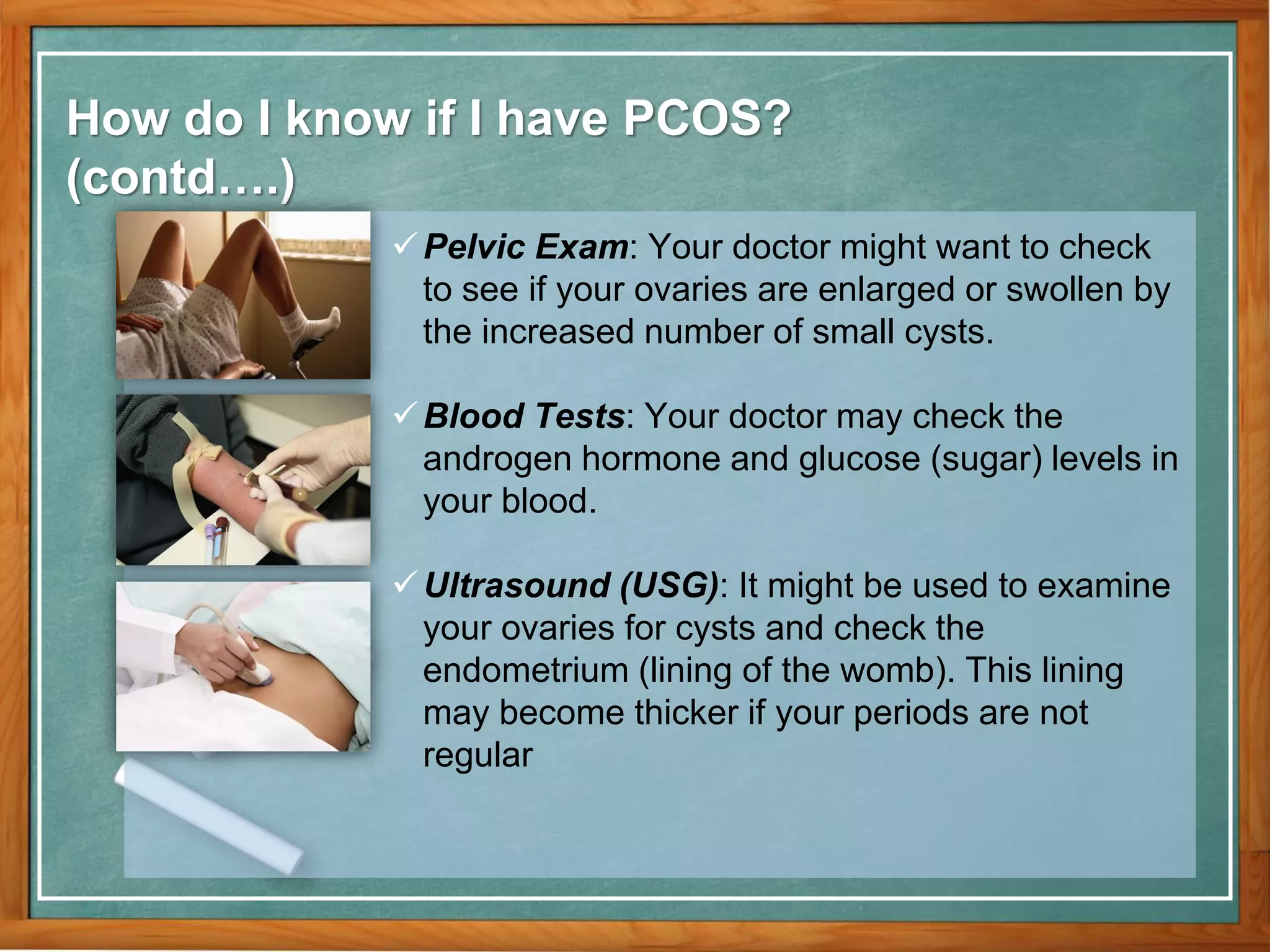 PCOS patient education | PDF