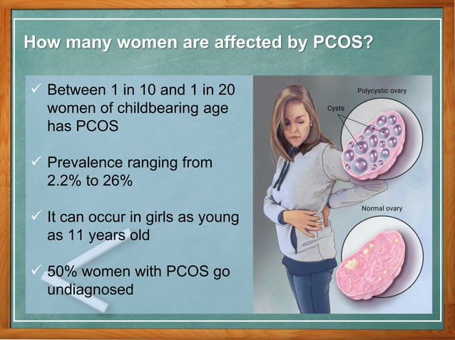 PCOS patient education | PDF