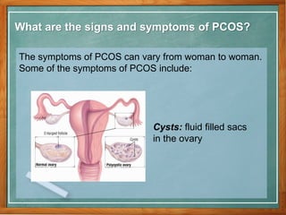 PCOS patient education | PDF