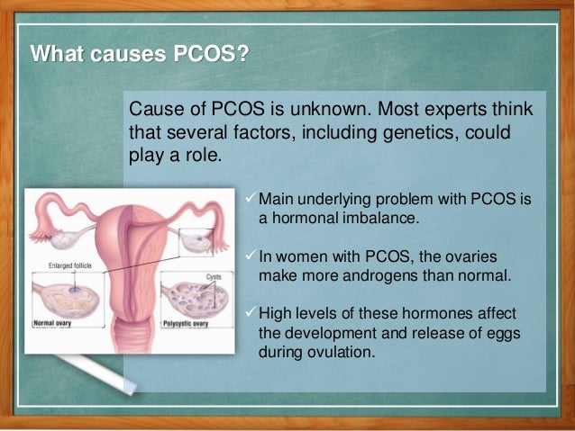PCOS patient education