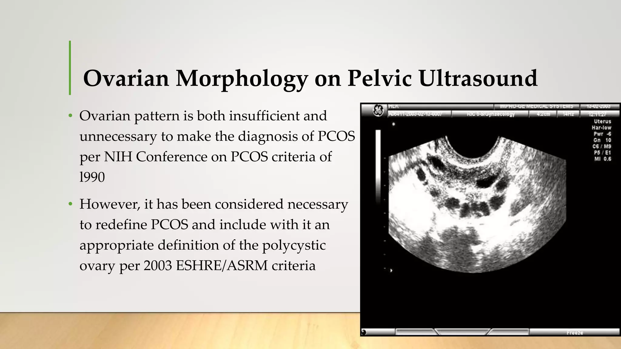 Polycystic ovarian disease (PCOS) | PPTX | Infertility | Reproductive Health