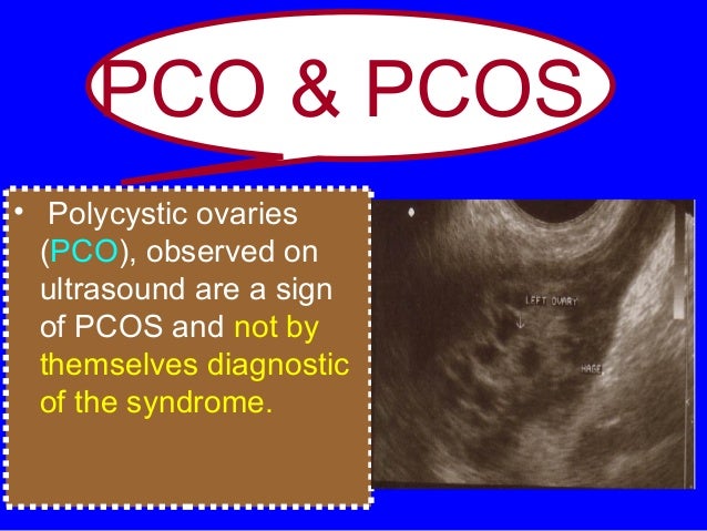 Pcos current concepts dr rabi