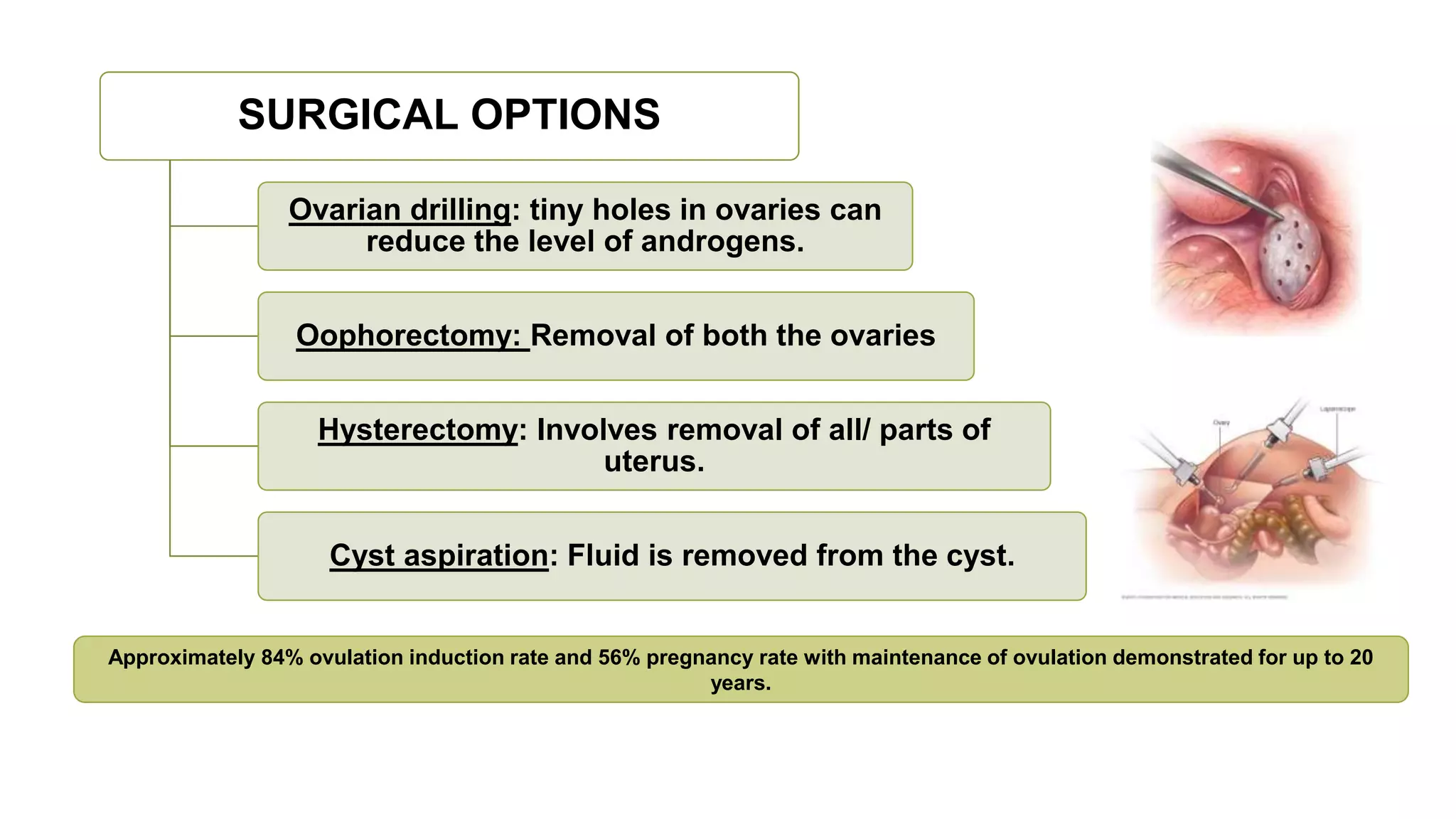 PCOS (Polycystic ovary syndrome) | PPTX