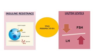 PCOS (Polycystic ovary syndrome) | PPTX