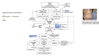 PCOS (Polycystic ovary syndrome) | PPTX