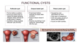 PCOS (Polycystic ovary syndrome) | PPTX