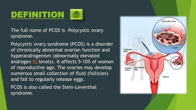 Pcos disease presentation | PPTX