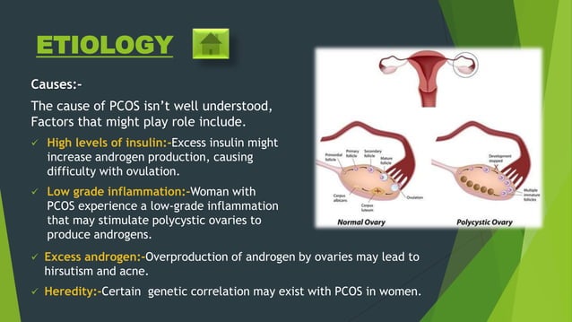 Pcos disease presentation | PPTX