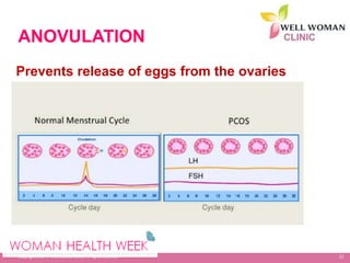Polycystic Ovaries (PCOS) & Fertility | PPT