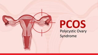 PCOS for doctors.pptx