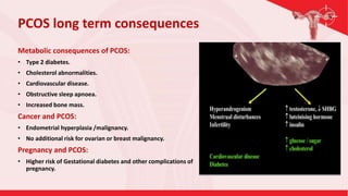 PCOS for doctors.pptx