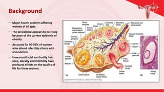 PCOS for doctors.pptx