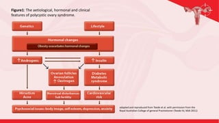 PCOS for doctors.pptx
