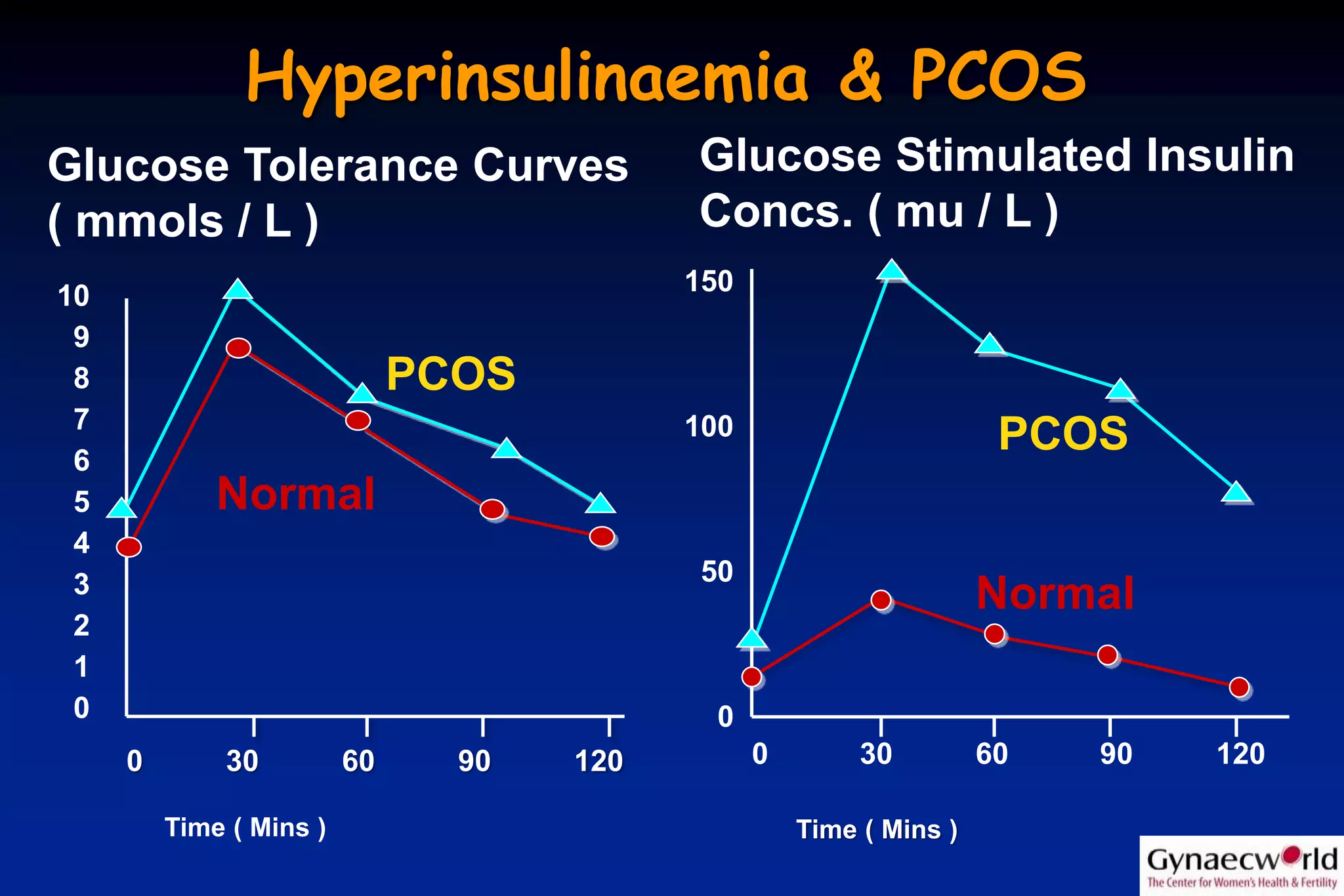 pcos_infertility_overview_usv15th_may_2016.ppt