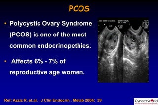 pcos_infertility_overview_usv15th_may_2016.ppt