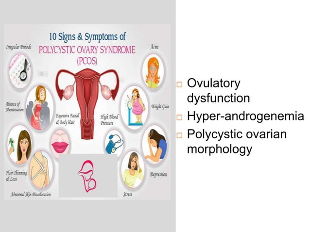 PCOS.. international guidelines ..changes everyone wants to know | PPTX ...