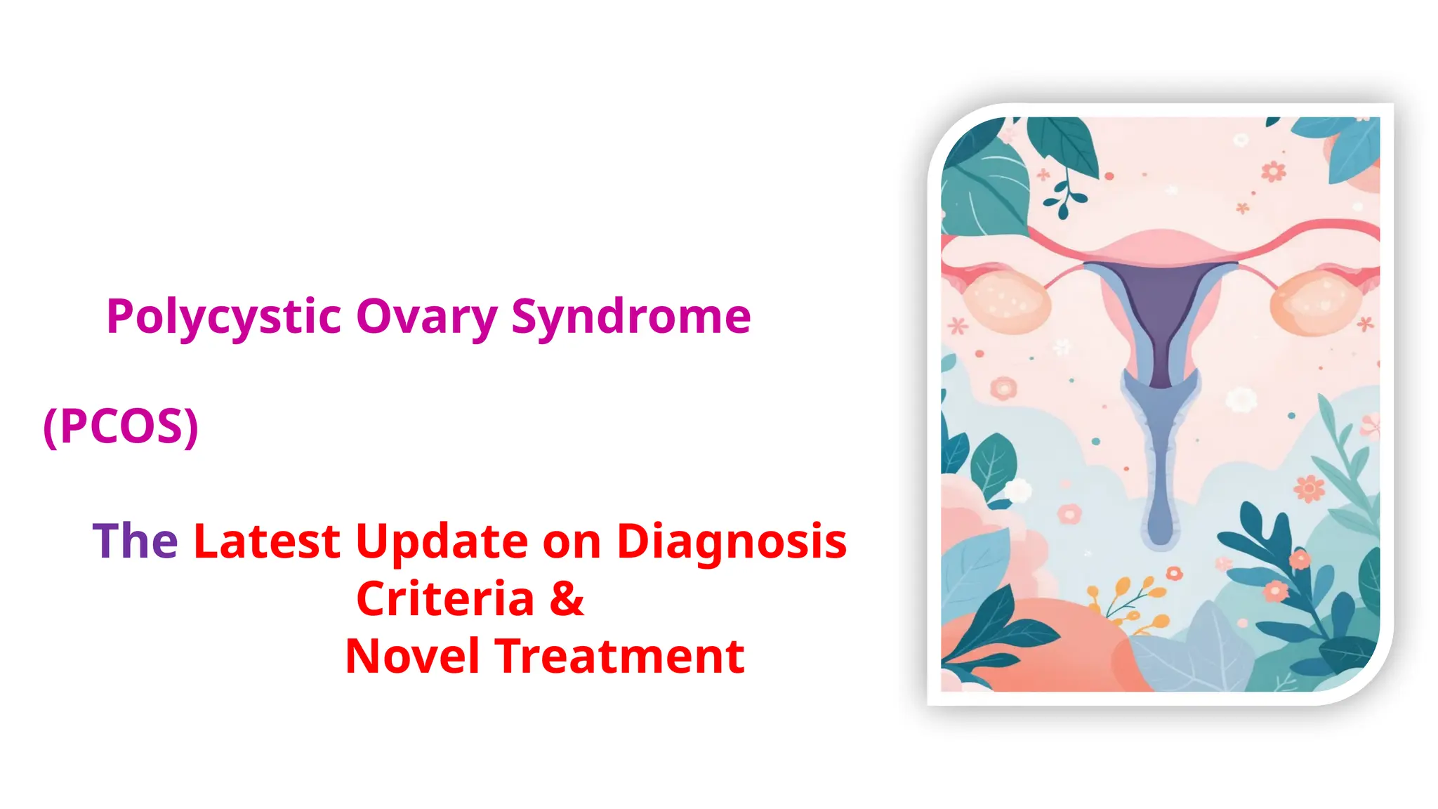 PCOS latest updates on diagnosis criteria and Novel Treatment | PPTX