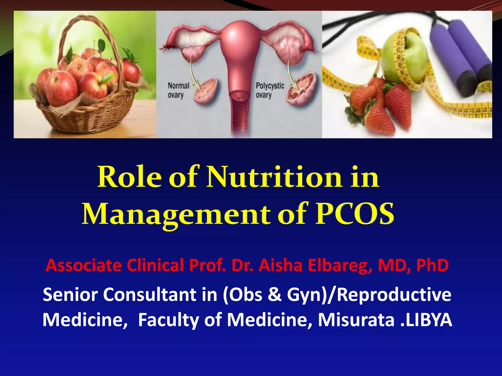 Role of Nutrition in Management of PCOS | PDF