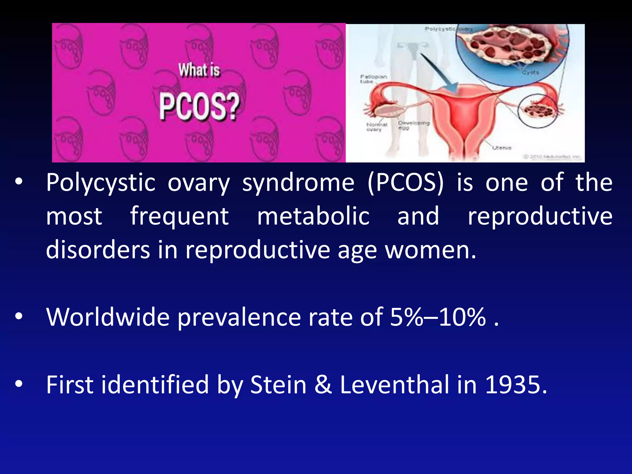 Role of Nutrition in Management of PCOS | PDF