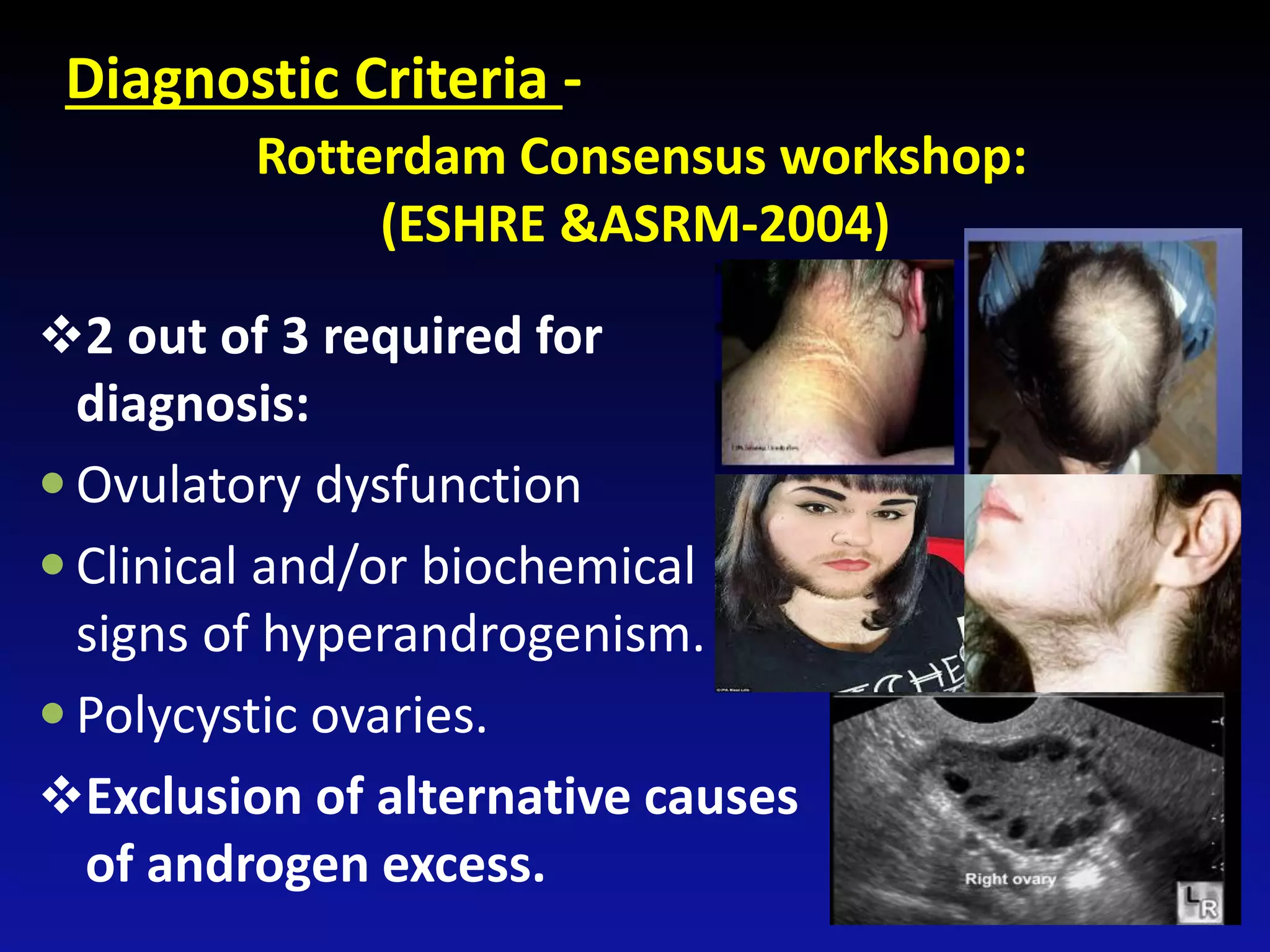Role of Nutrition in Management of PCOS | PDF