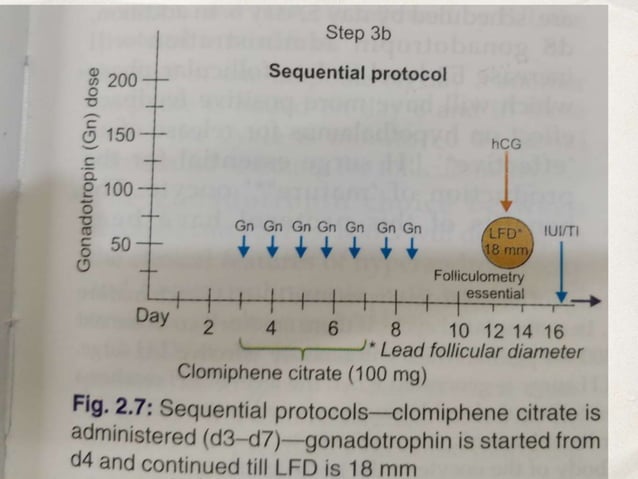 Pcos Panel Discussion | PPTX | Pregnancy | Reproductive Health