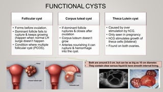 pcos presentation .pptx