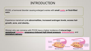pcos presentation .pptx