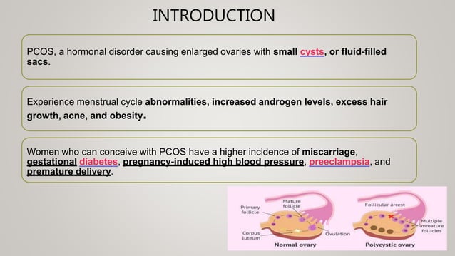 pcos presentation .pptx