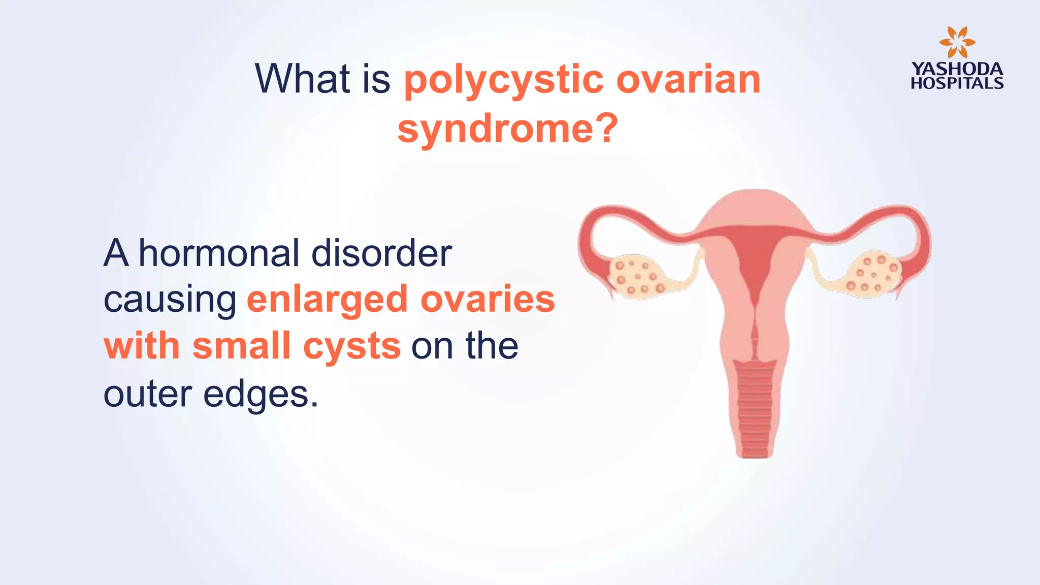Polycystic Ovary Syndrome (PCOS): Symptoms, Causes and Treatment | PPTX | Hormonal Disorders ...