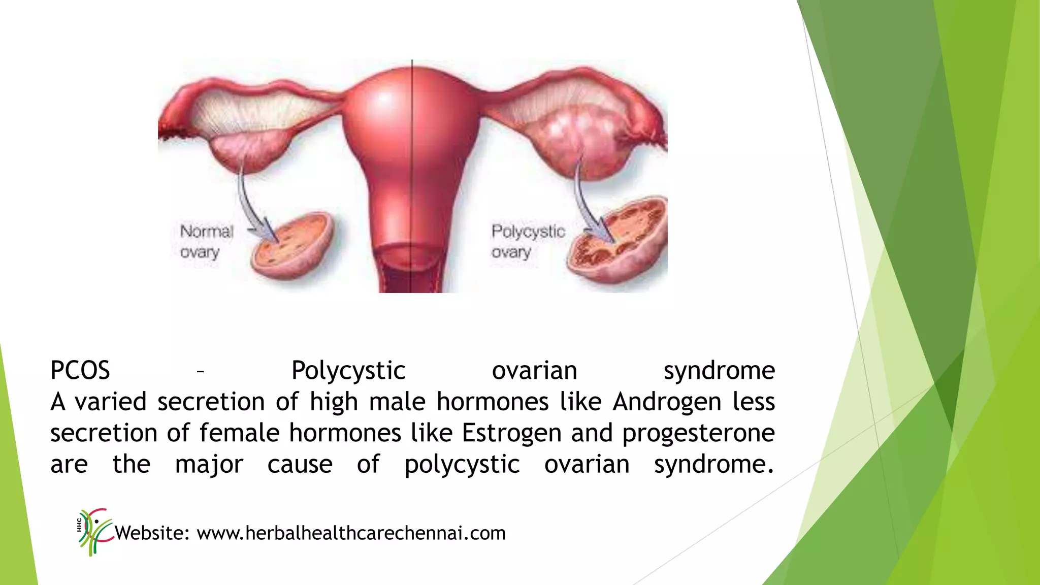 Pcos treatment in siddha | PPTX