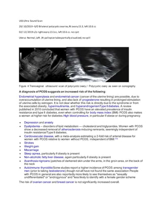 Pcos with infertility and its ayurveda and unani combined treatment | DOCX