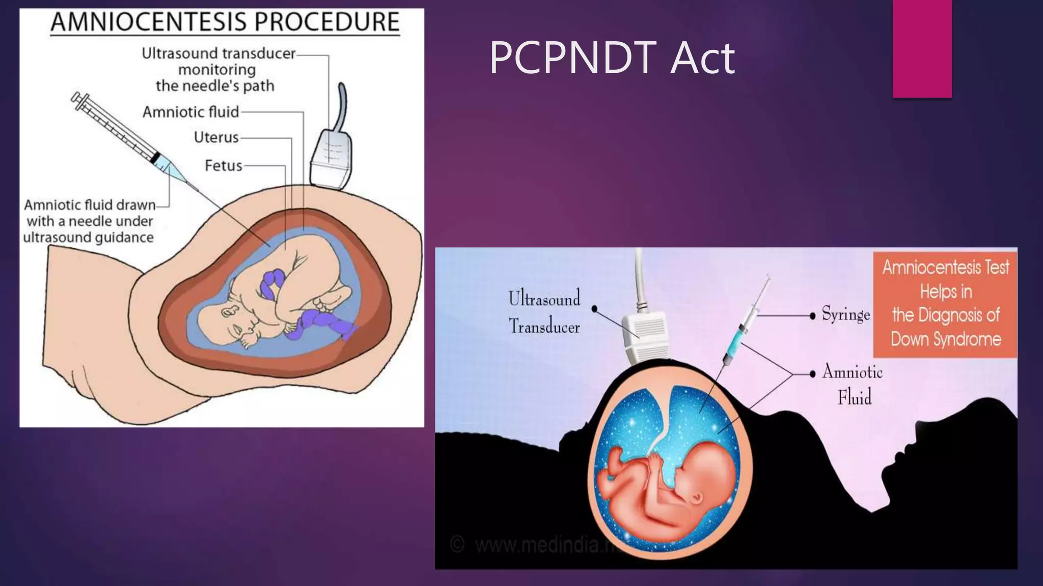 Pcpndt act by m b singh 5 8-2020 | PPTX